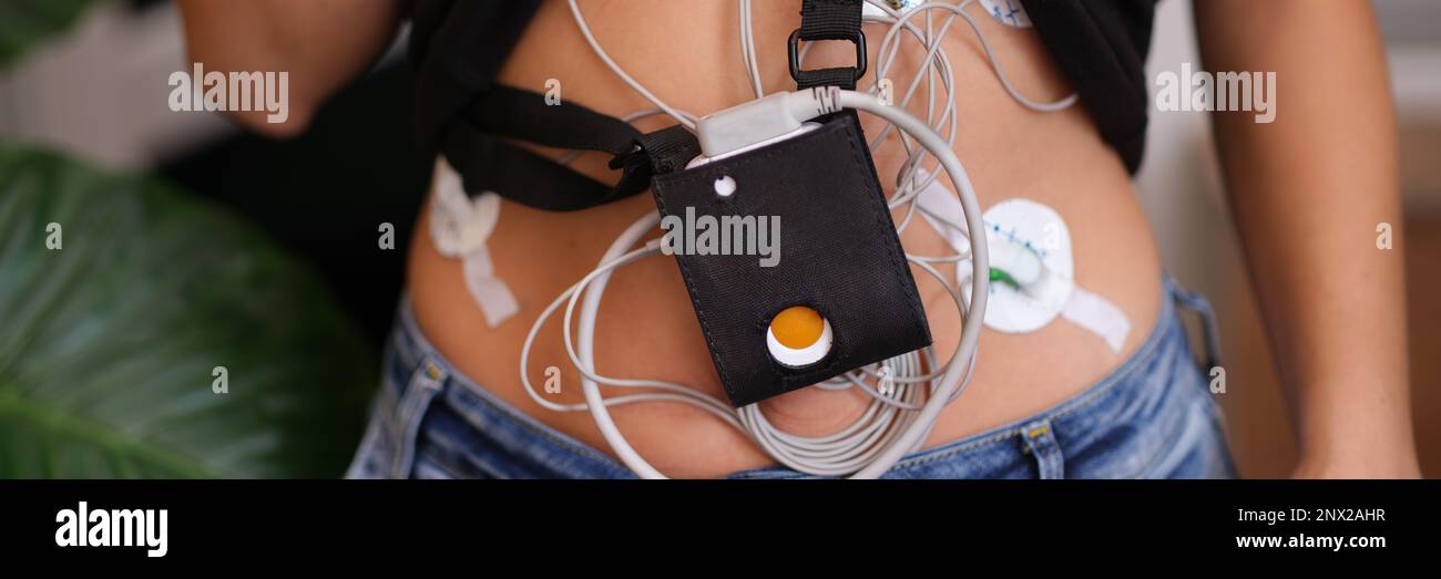 24-hour ECG monitoring and Holter monitoring on a woman body Stock ... 24-hour ECG monitoring and Holter monitoring on a woman body Stock ...