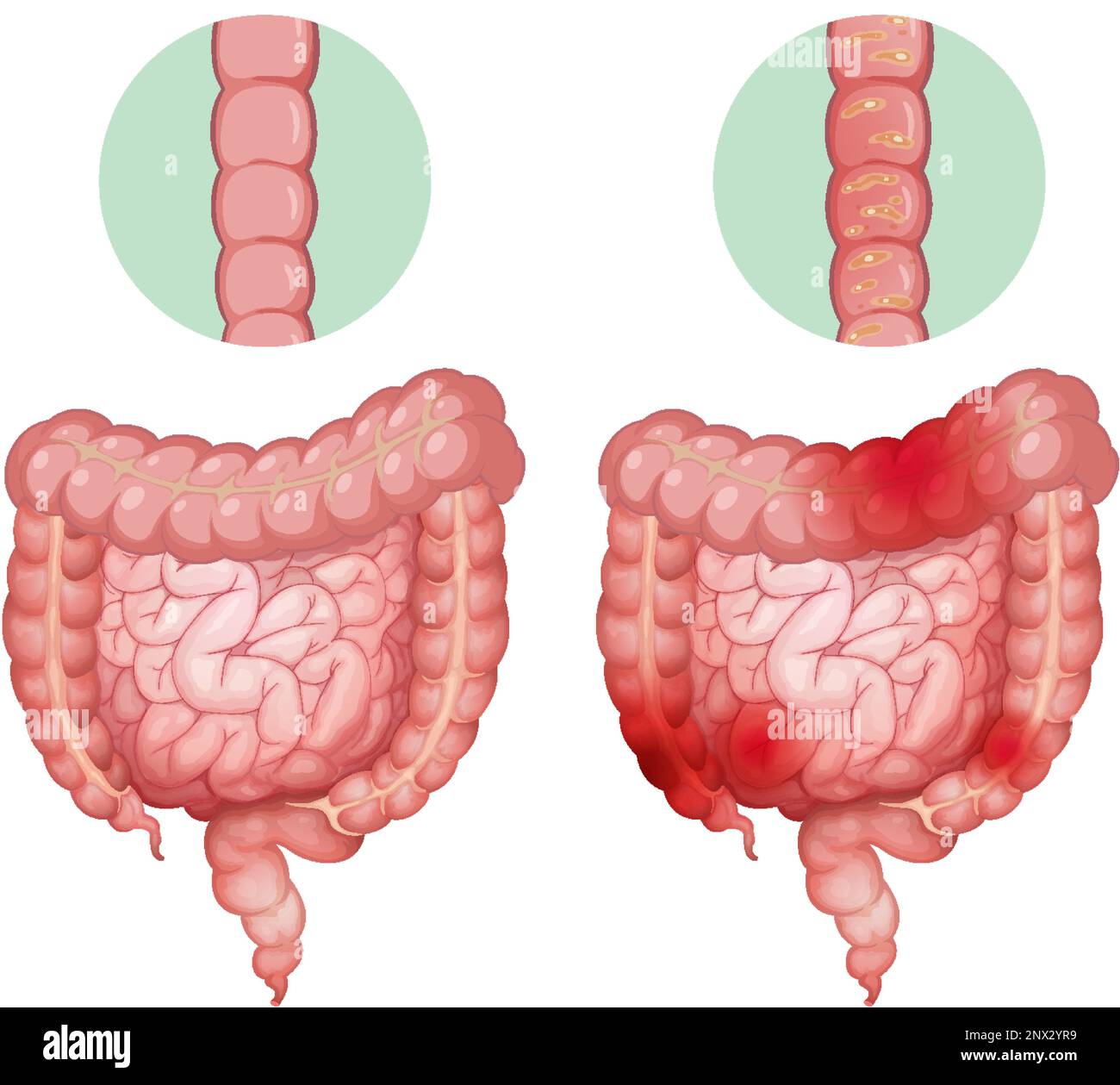 Human internal organ small and large intestine illustration Stock ...