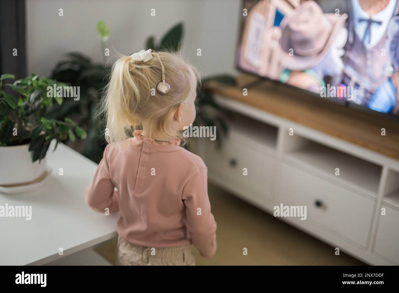 Cochlear implant system. Installation cochlear implant on child girl ...