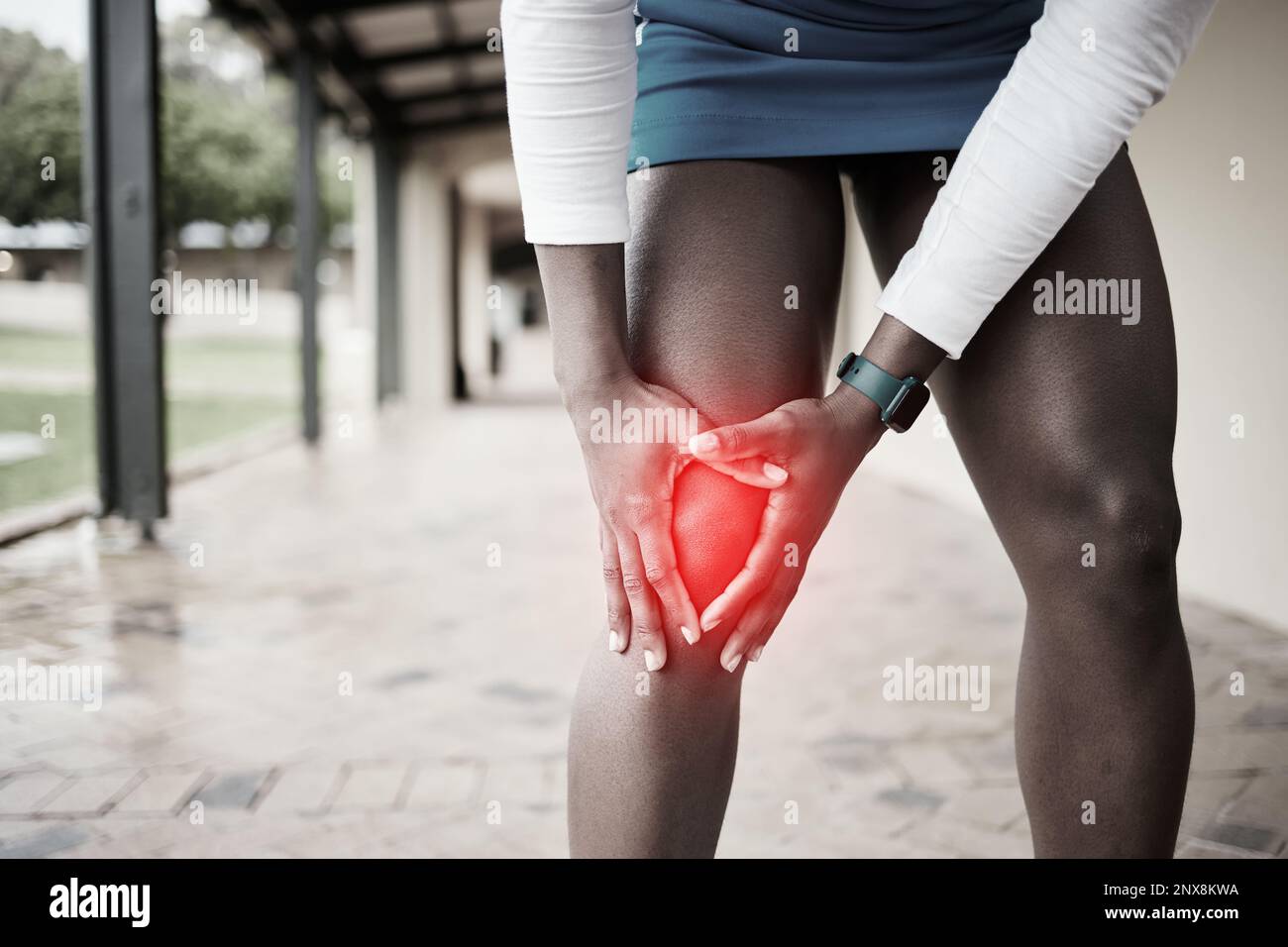 Fitness, netball and knee pain with leg of black woman for sports ...