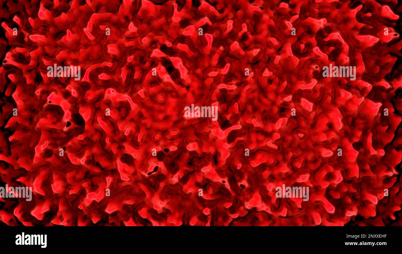 Antibiotic resistant bacteria illness infection and inflammation ...