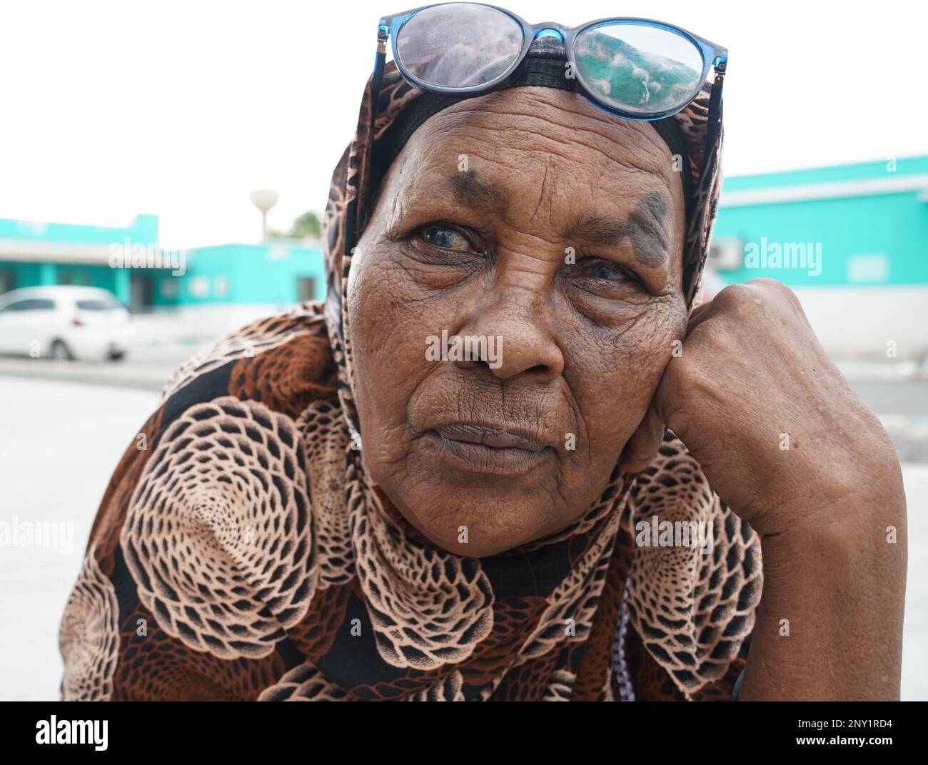 Djibouti City, Djibouti. 28th Feb, 2023. A local patient of cataract ...
