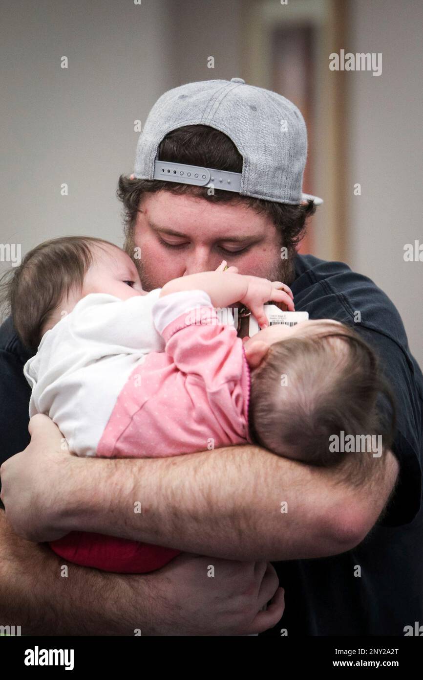 Nick Torres hugs his daughters, conjoined twins, Carter, left, and ...