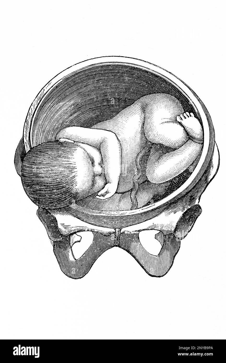 Next birth. Baby inside the womb with transverse position Stock Photo ... Next birth. Baby inside the womb with transverse position Stock Photo ...