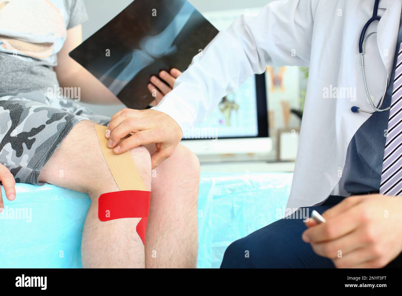 X-ray image of knee injury patient with kinesio tape on knee at ...