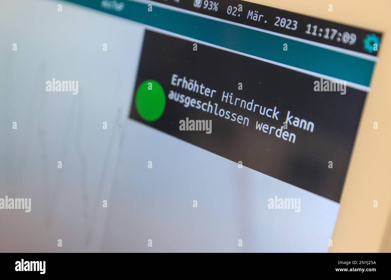 Leipzig, Germany. 02nd Mar, 2023. The display on a screen from Sonovum ...
