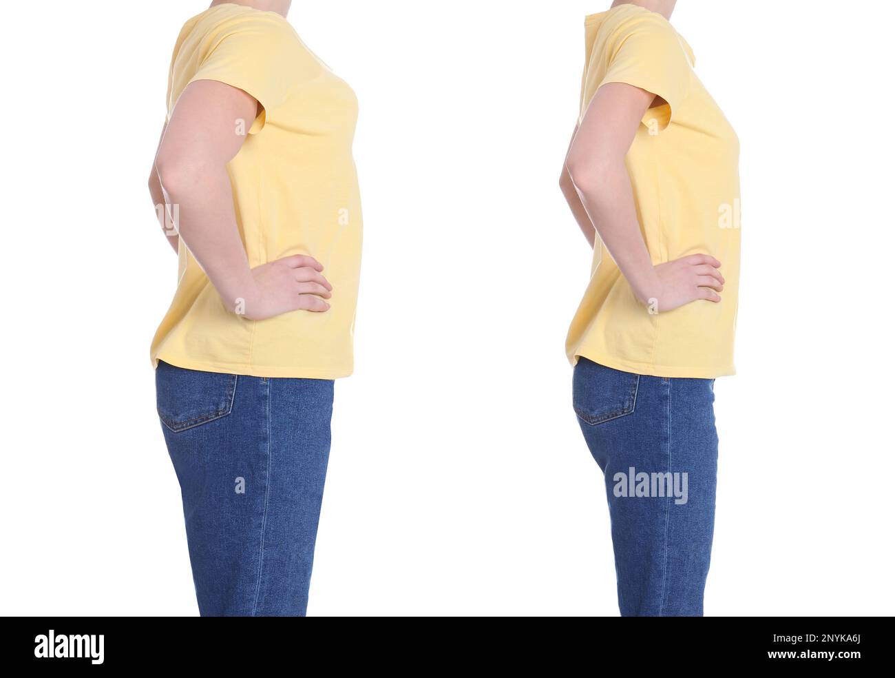 Collage with photos of woman before and after weight loss diet on white ...