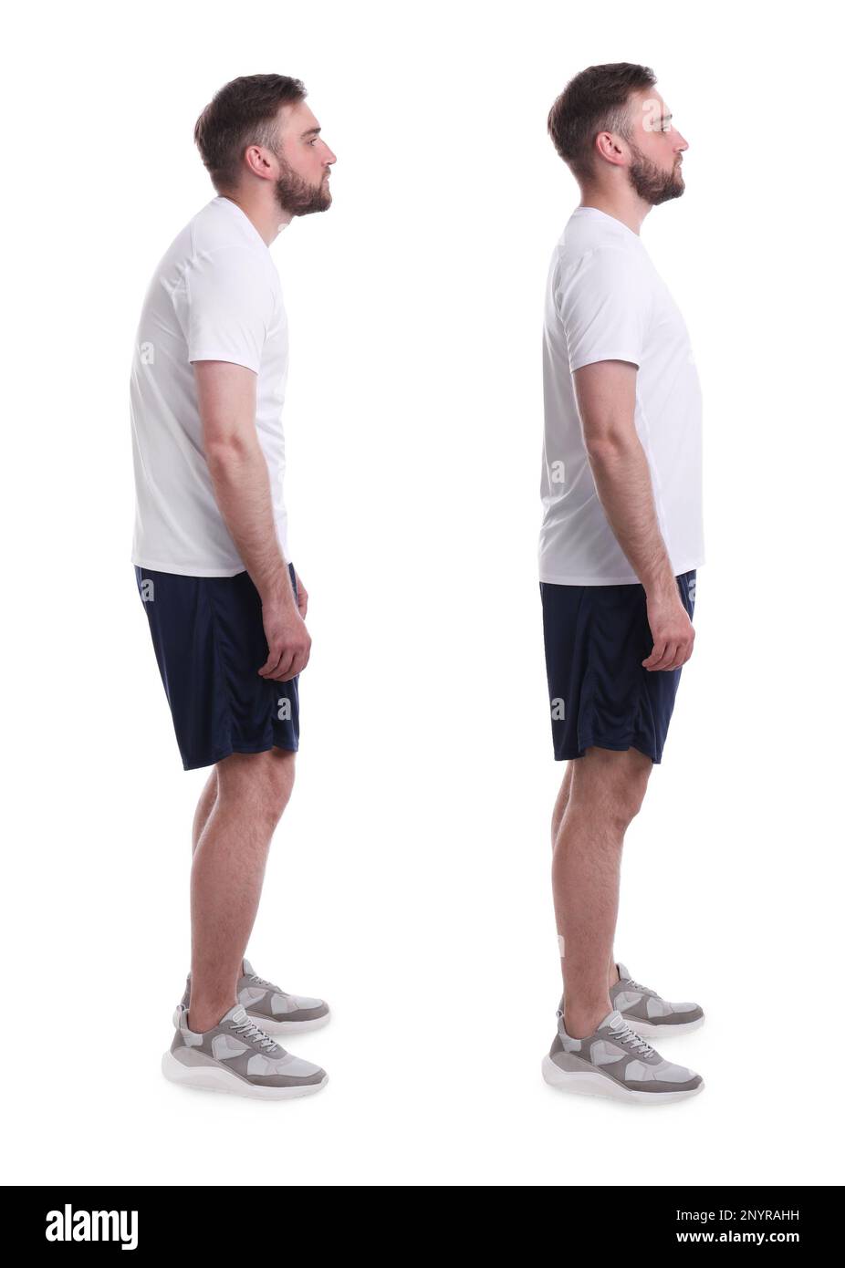 Collage with photos of young man with poor and good posture on white ...