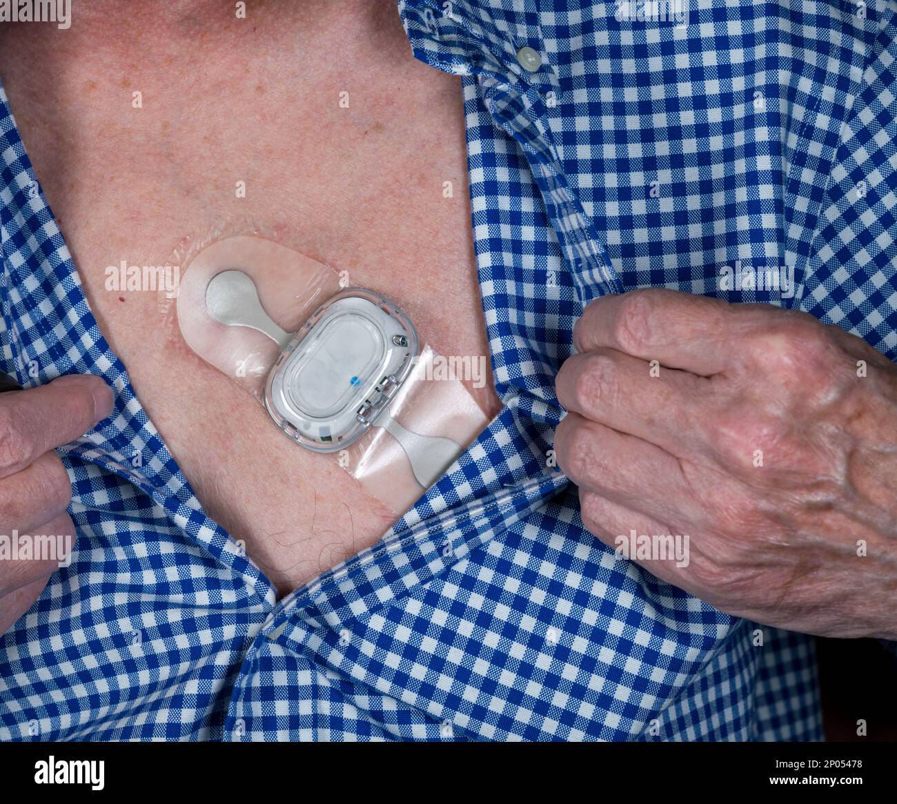 Small Adhesive Heart Ecg Long Term Heart Rate Monitor On Male Chest