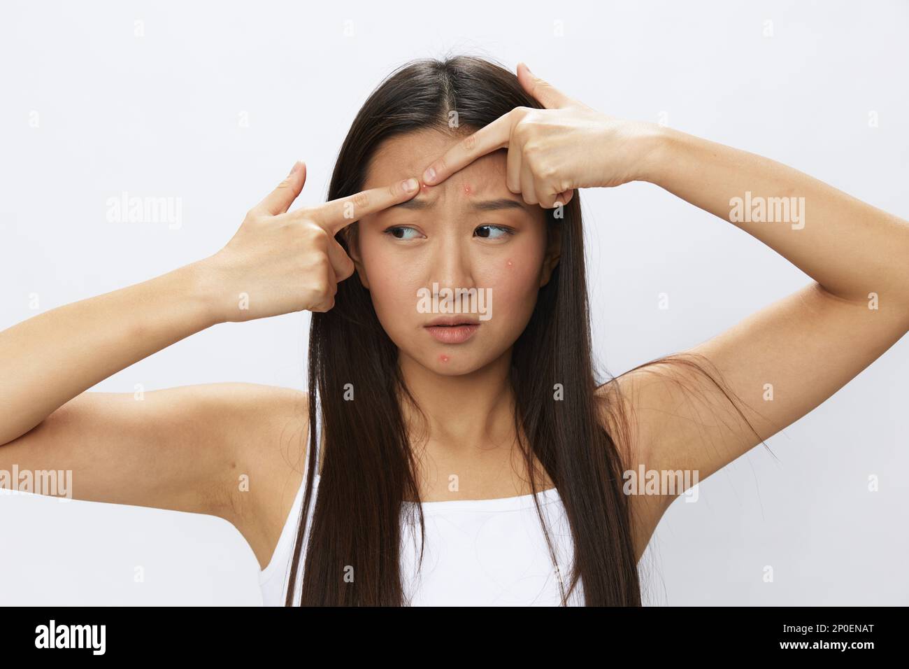 Asian woman facial skin problems, acne and inflammation, red rashes and ...