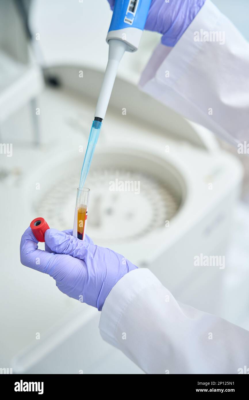 Laboratory employee prepares a biomaterial for loading into biochemical ...