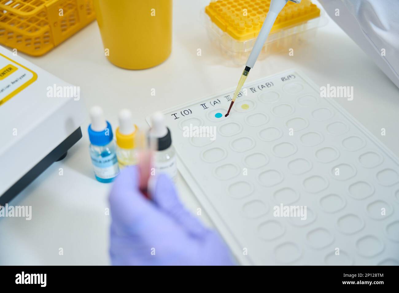 Worker in a chemical laboratory conducts a blood type test Stock Photo ...