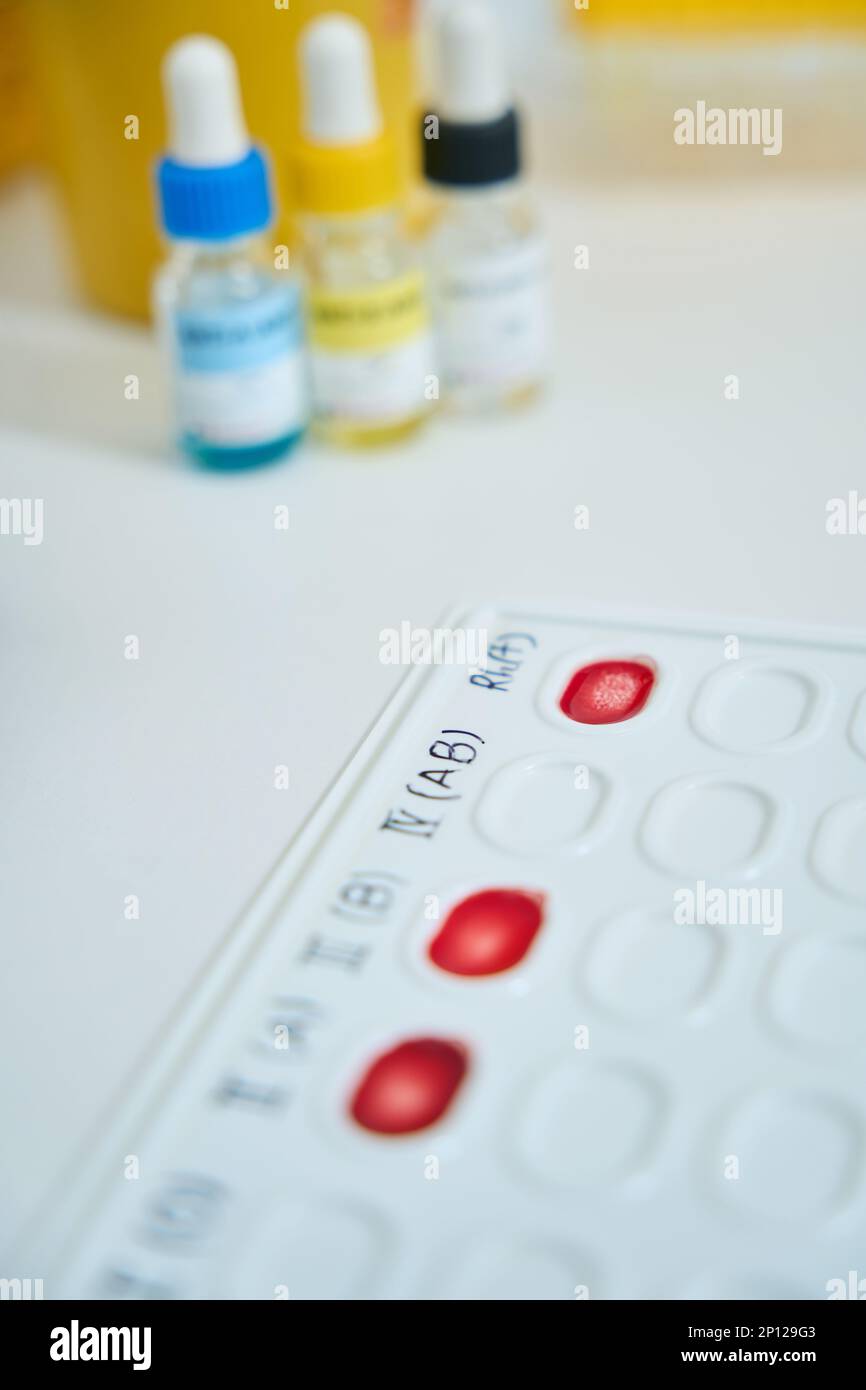 Blood samples on an indicator palette are on laboratory table Stock ...