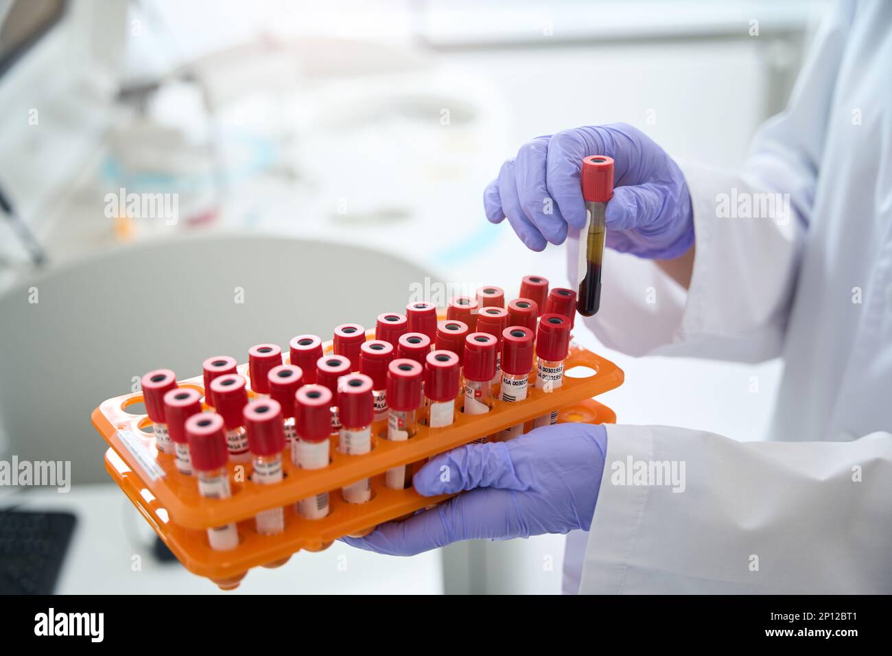 Doctor holding tubes prepared in laboratory centrifuge machine blood ...