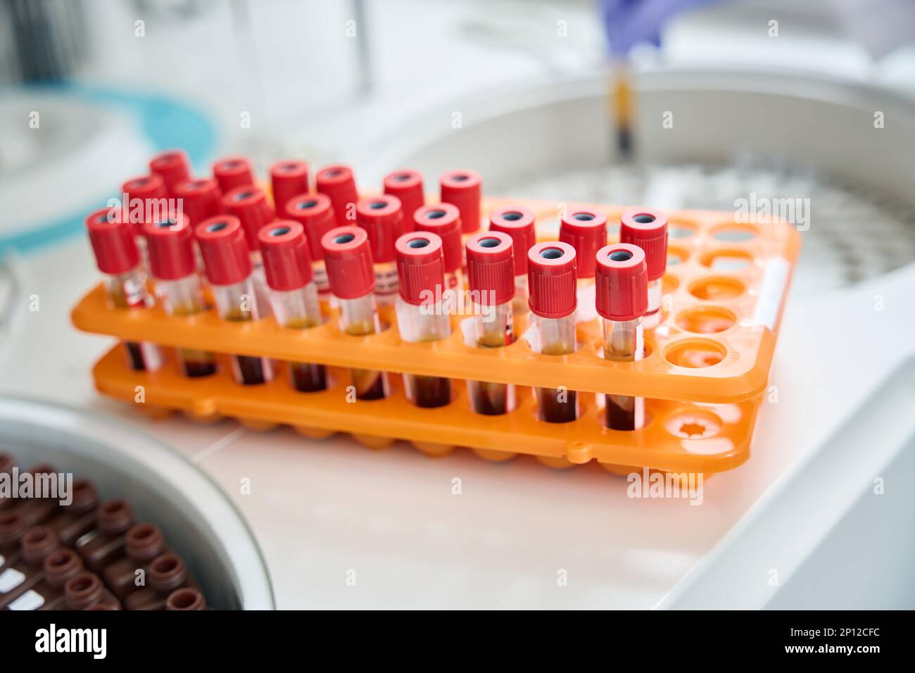 Rack of blood tubes with barcode labels for proper identification Stock ...