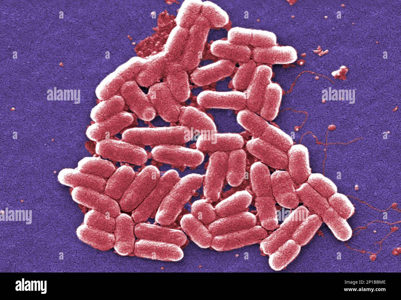 This 2006 colorized scanning electron micrograph image made available ...