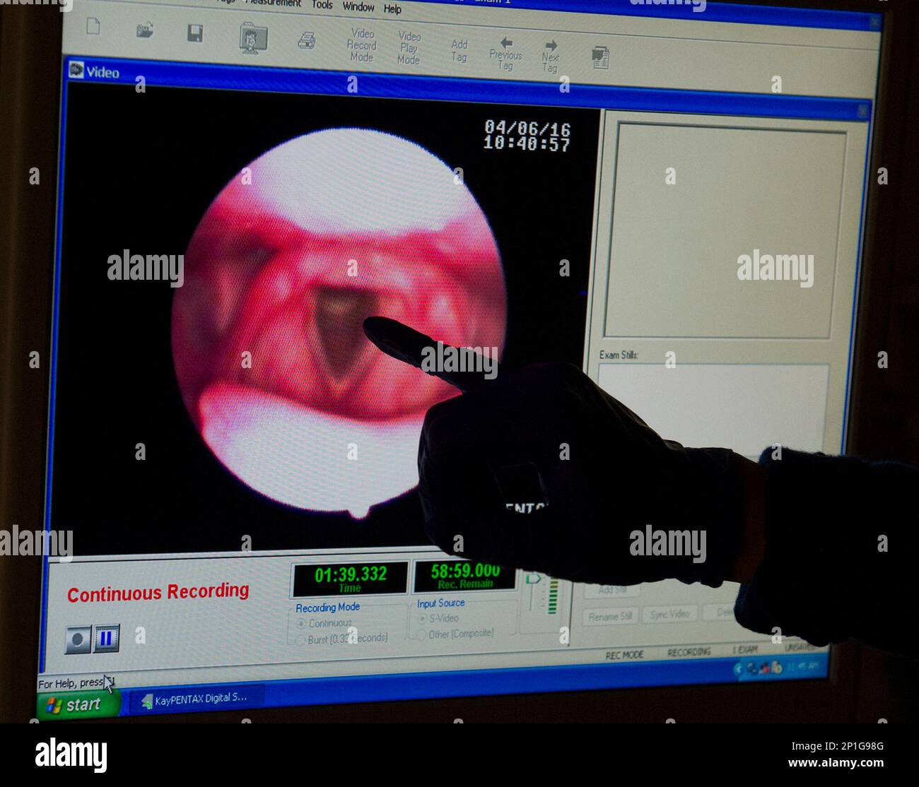 ADVANCE FOR USE SUNDAY, APRIL 17 - In this photo taken April 6, 2016, a ...