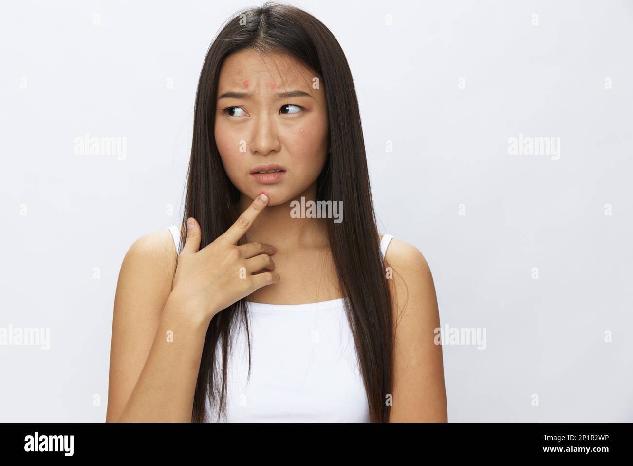 Asian woman facial skin problems, acne and inflammation, red rashes and ...