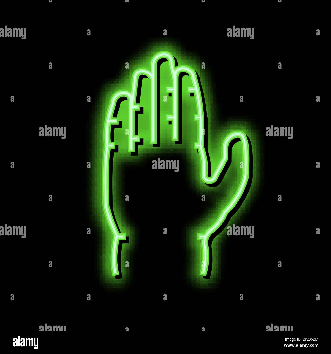 Edema arm hi-res stock photography and images - Alamy