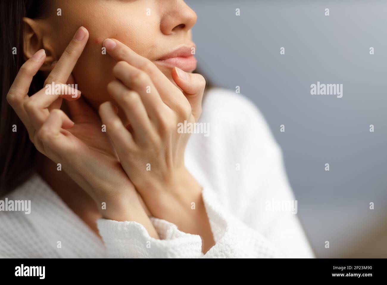 Squeezes upset young woman in white bathrobe examines pimples on her ...