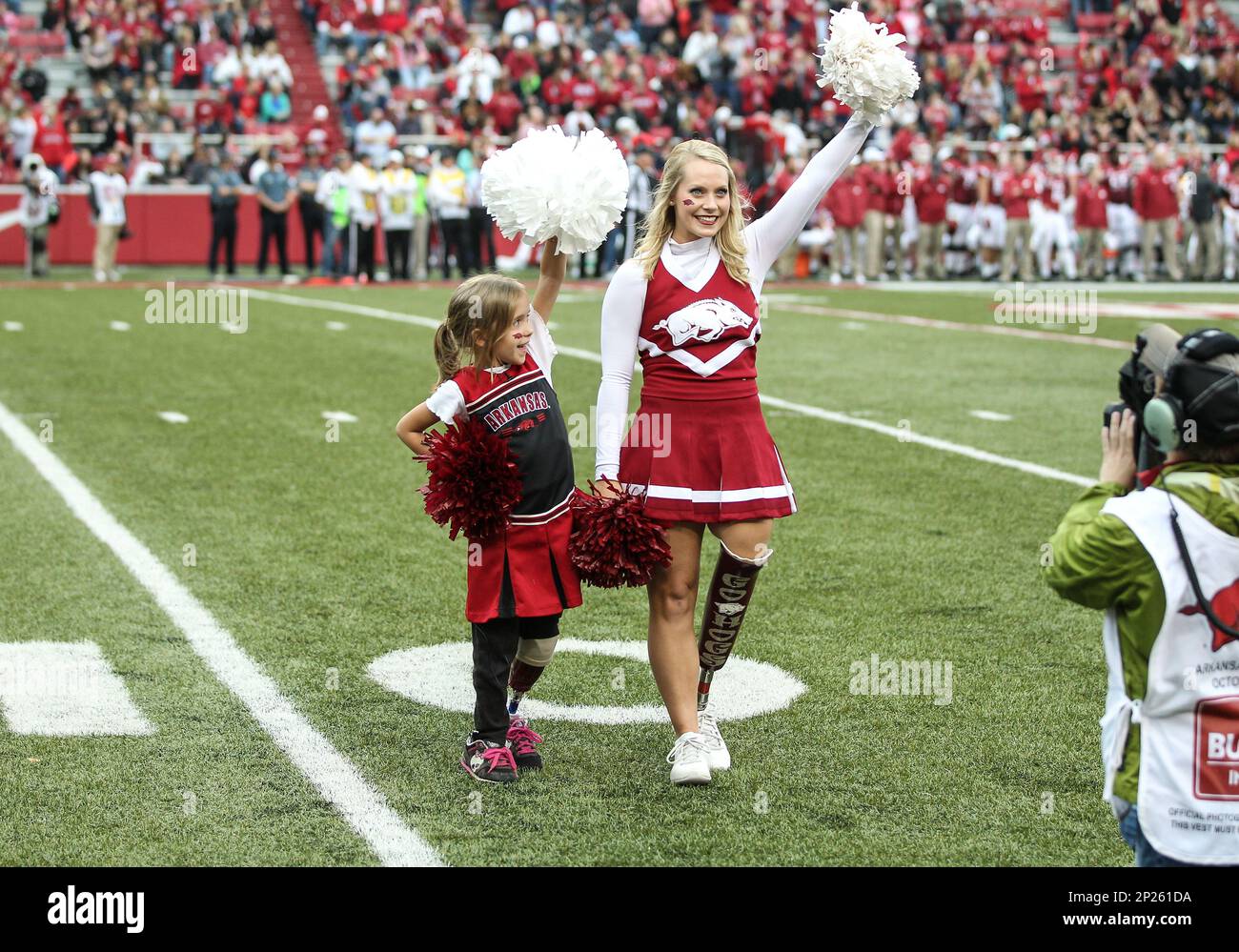University Of Arkansas Amputee Cheerleader