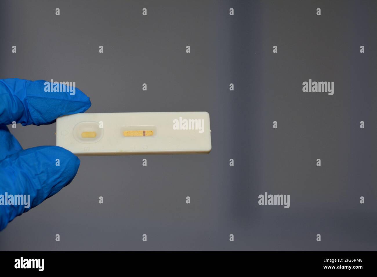 Negative urine pregnancy test, Human chorionic gonadotropin (hCG), a ...
