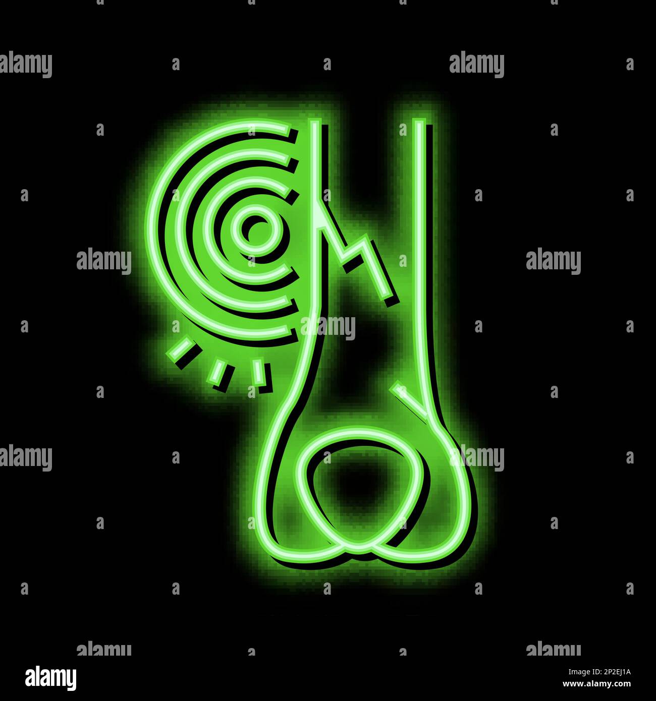 Open bone fracture icon Stock Vector Images - Alamy