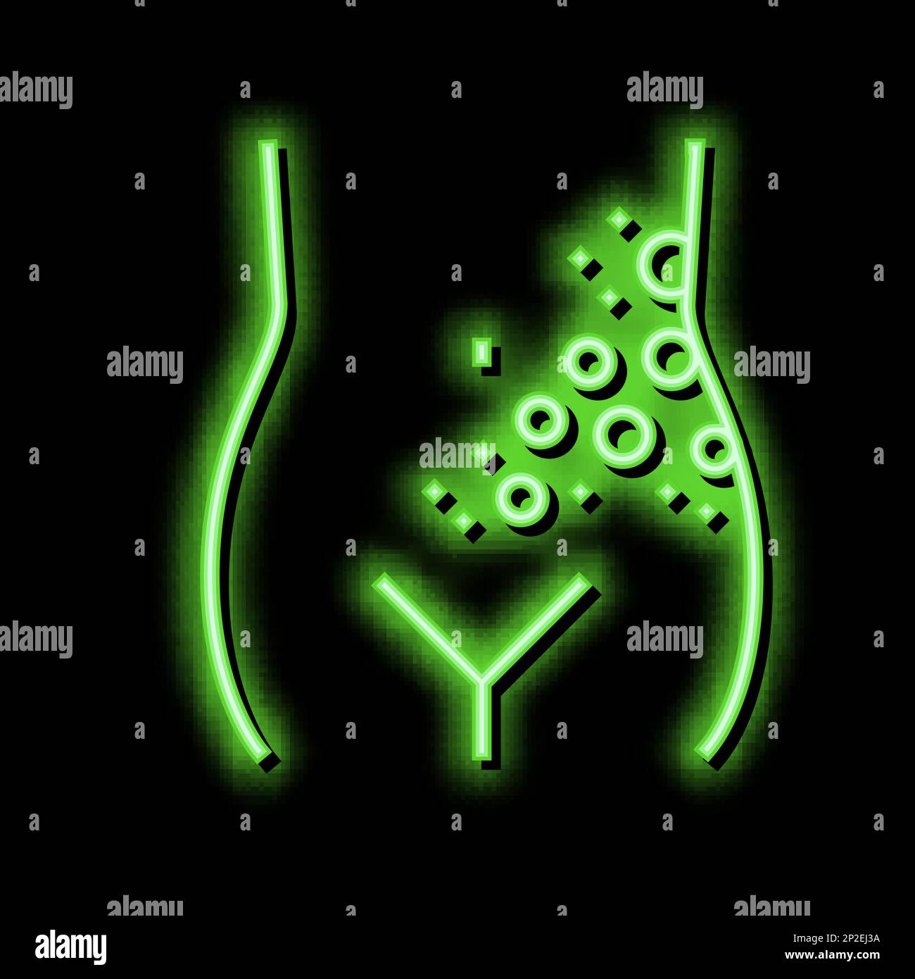 lichen shingles disease neon glow icon illustration Stock Vector Image ...