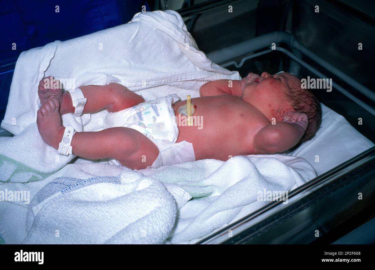 New Born Baby Girl in Cot with Umbilical Cord Clamp in Delivery Room ...