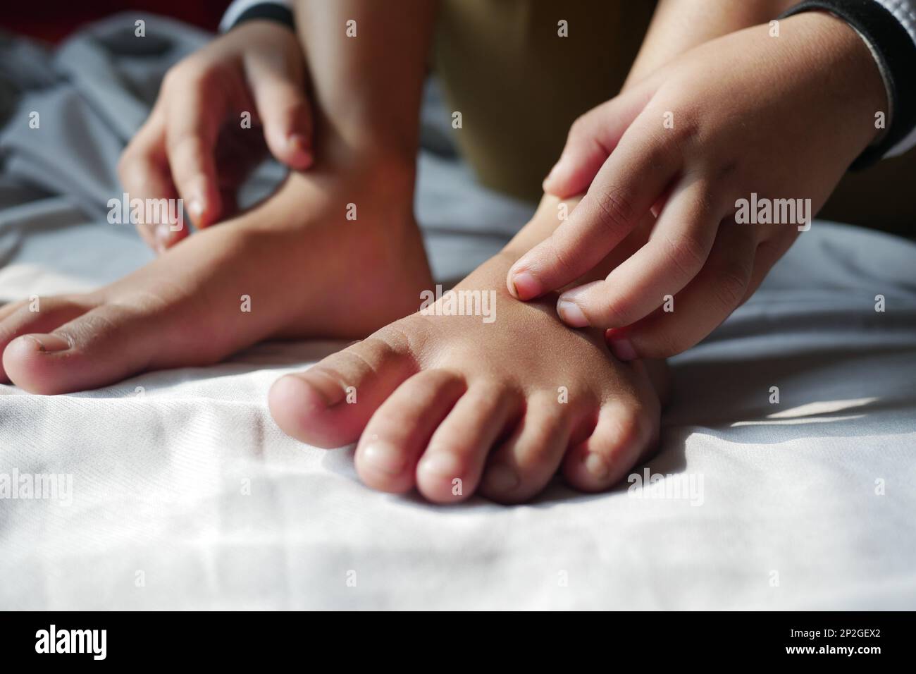 child girl suffering from itching skin, close up Stock Photo - Alamy
