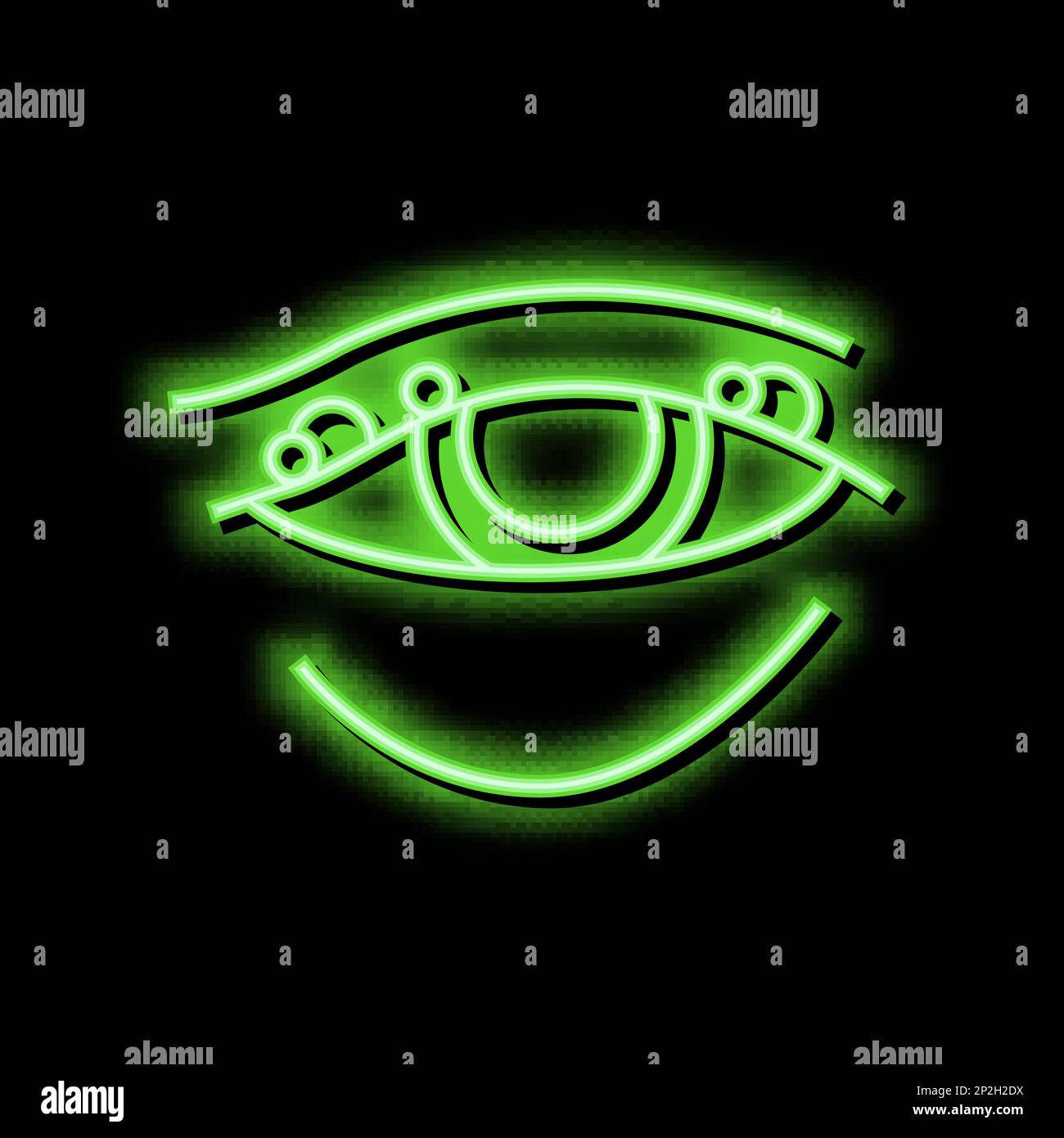 blepharitis disease, redness of eyeball neon glow icon illustration ...