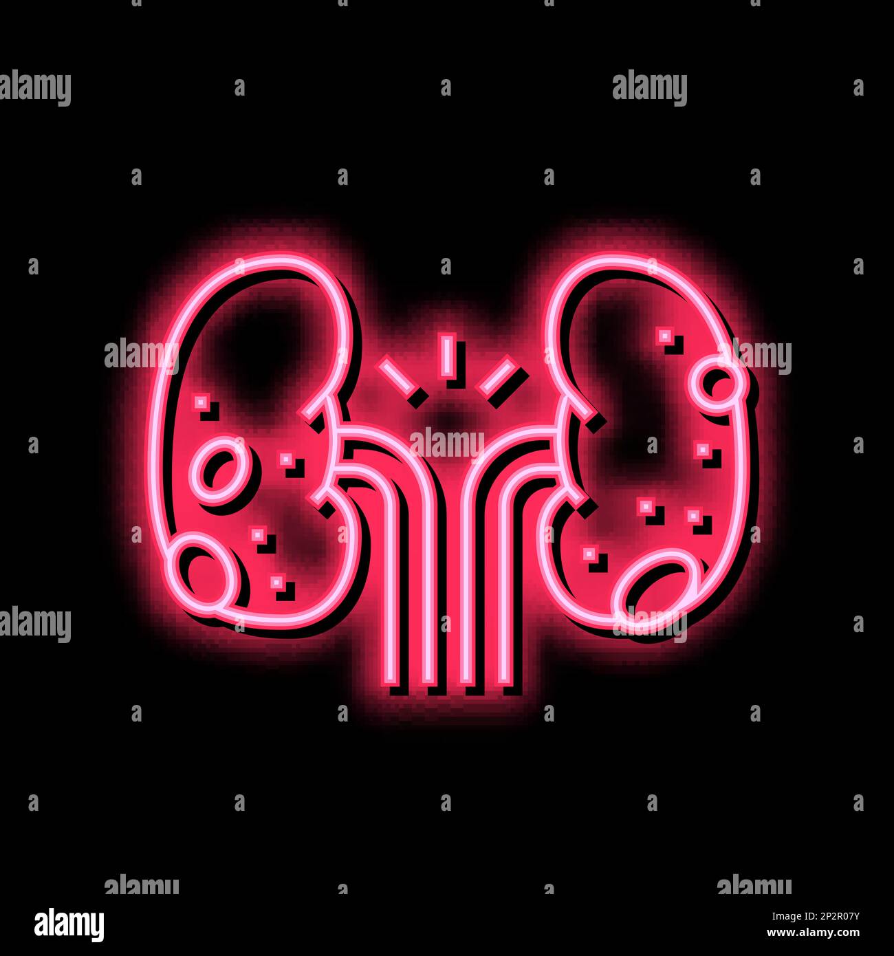 glomerulonephritis kidney disease neon glow icon illustration Stock ...