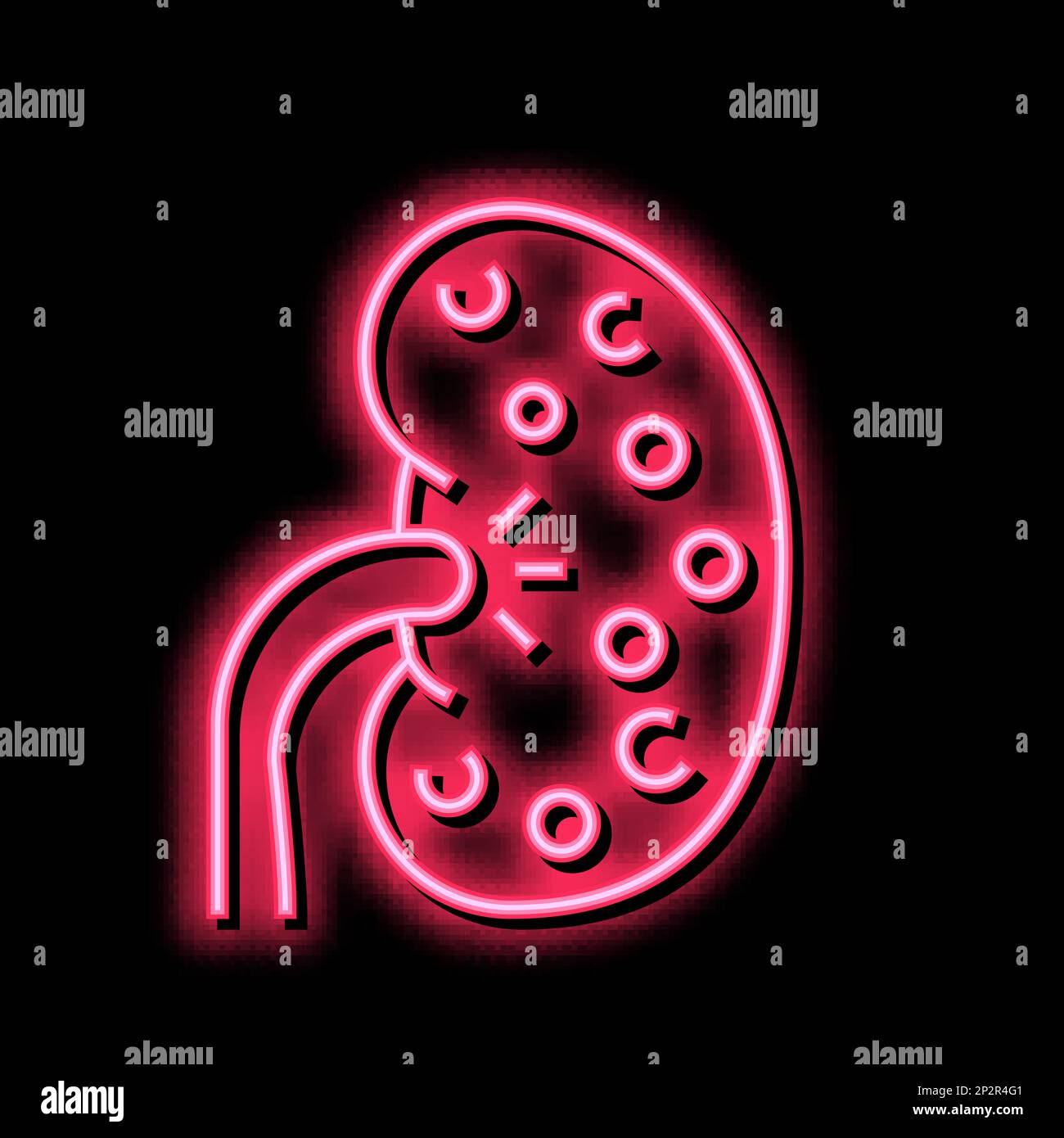 nephritis kidney neon glow icon illustration Stock Vector Image & Art ...