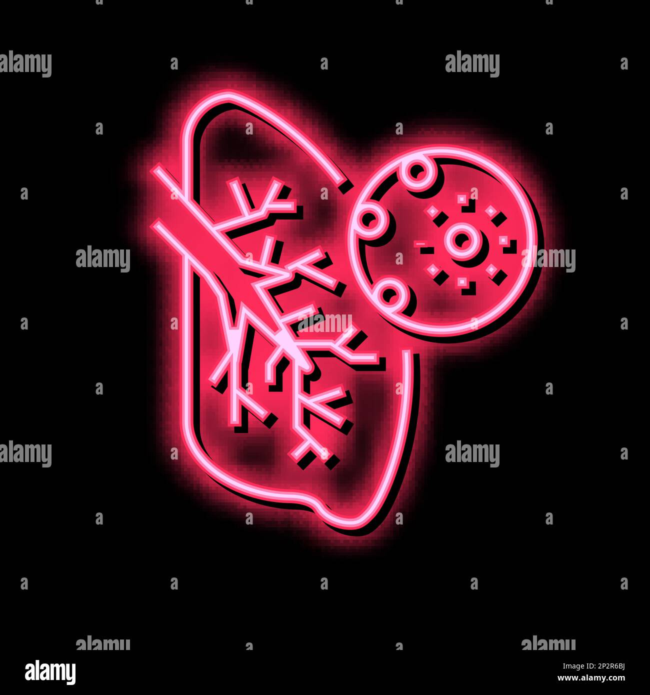 Cystic Fibrosis Respiratory Disease Neon Glow Icon Illustration Stock