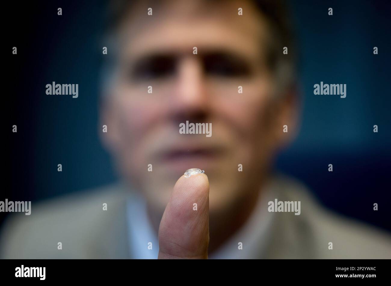 Dr. Garth Webb holds a bionic lens while sitting for a photograph at ...