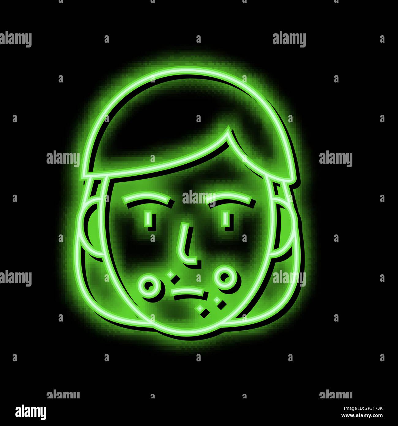 Umbilical Hernia Stock Vector Images Alamy