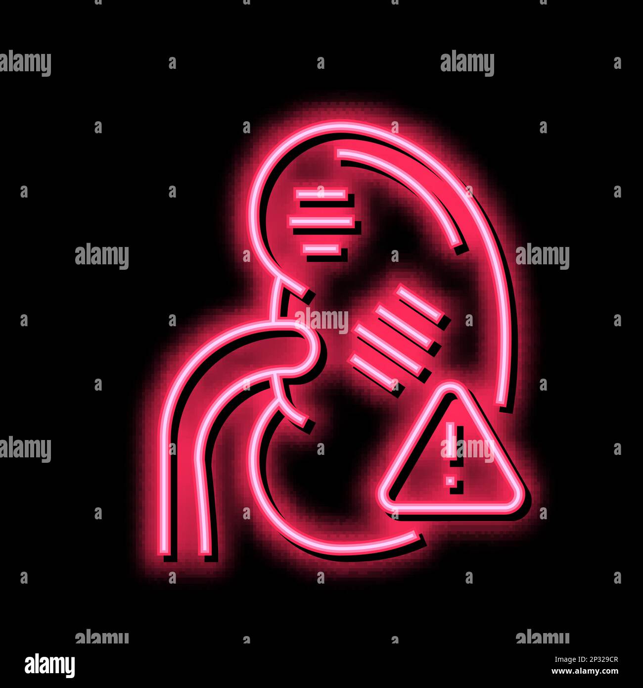 renal failure neon glow icon illustration Stock Vector Image & Art - Alamy