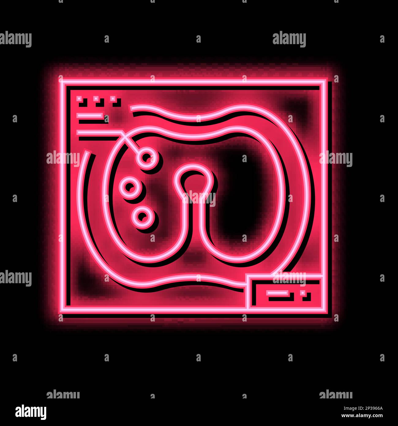 larynx x-ray neon glow icon illustration Stock Vector Image & Art - Alamy