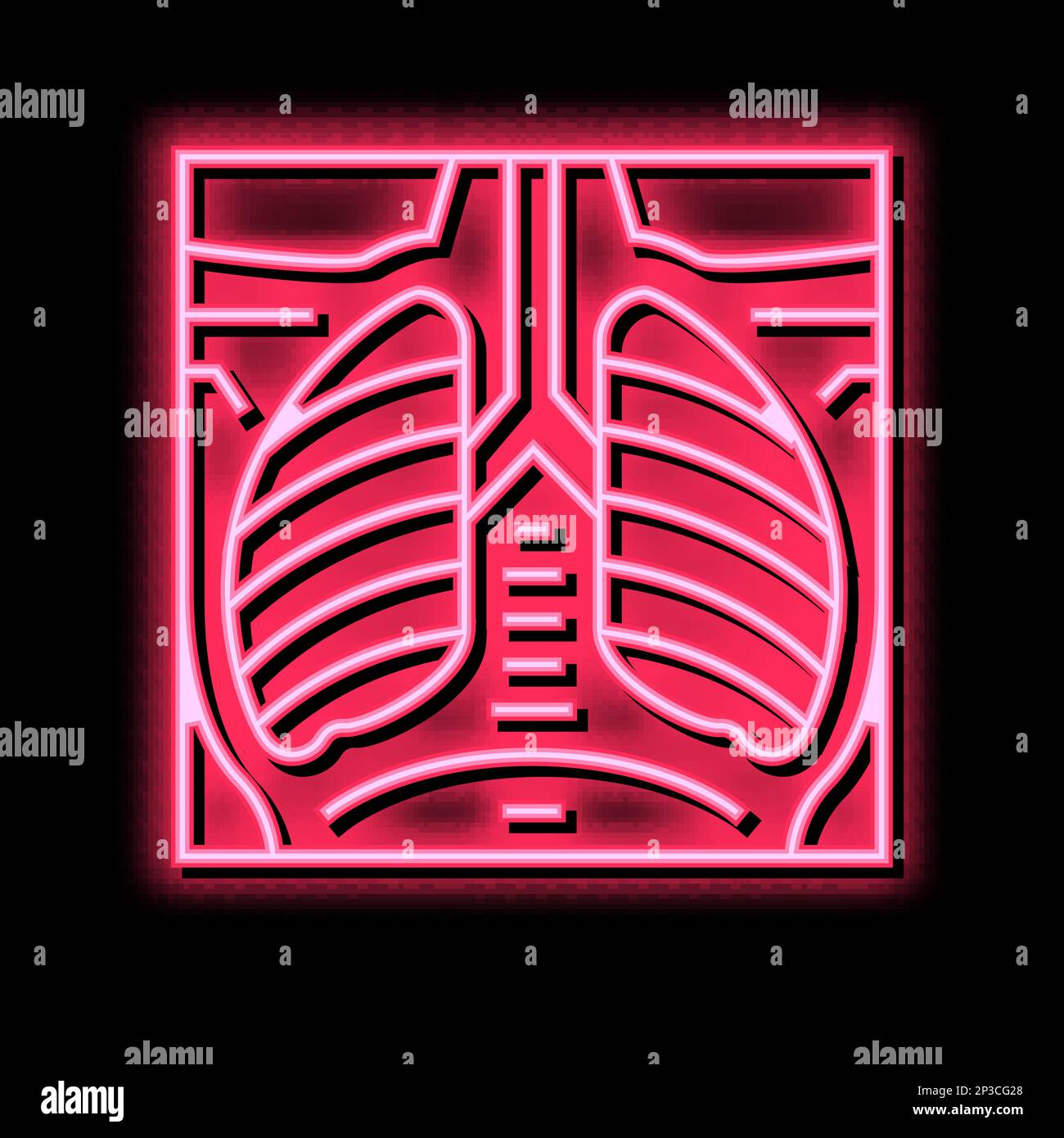lungs x-ray neon glow icon illustration Stock Vector Image & Art - Alamy