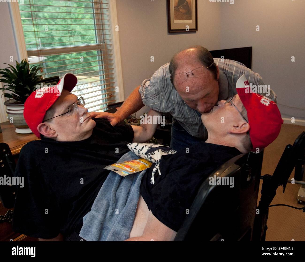 Ronnie And Donnie Galyon New Home World's Oldest Conjoined Twins