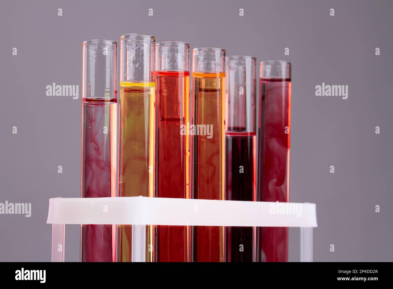Colorful rows of laboratory test tubes with blood. Isolated on gray ...