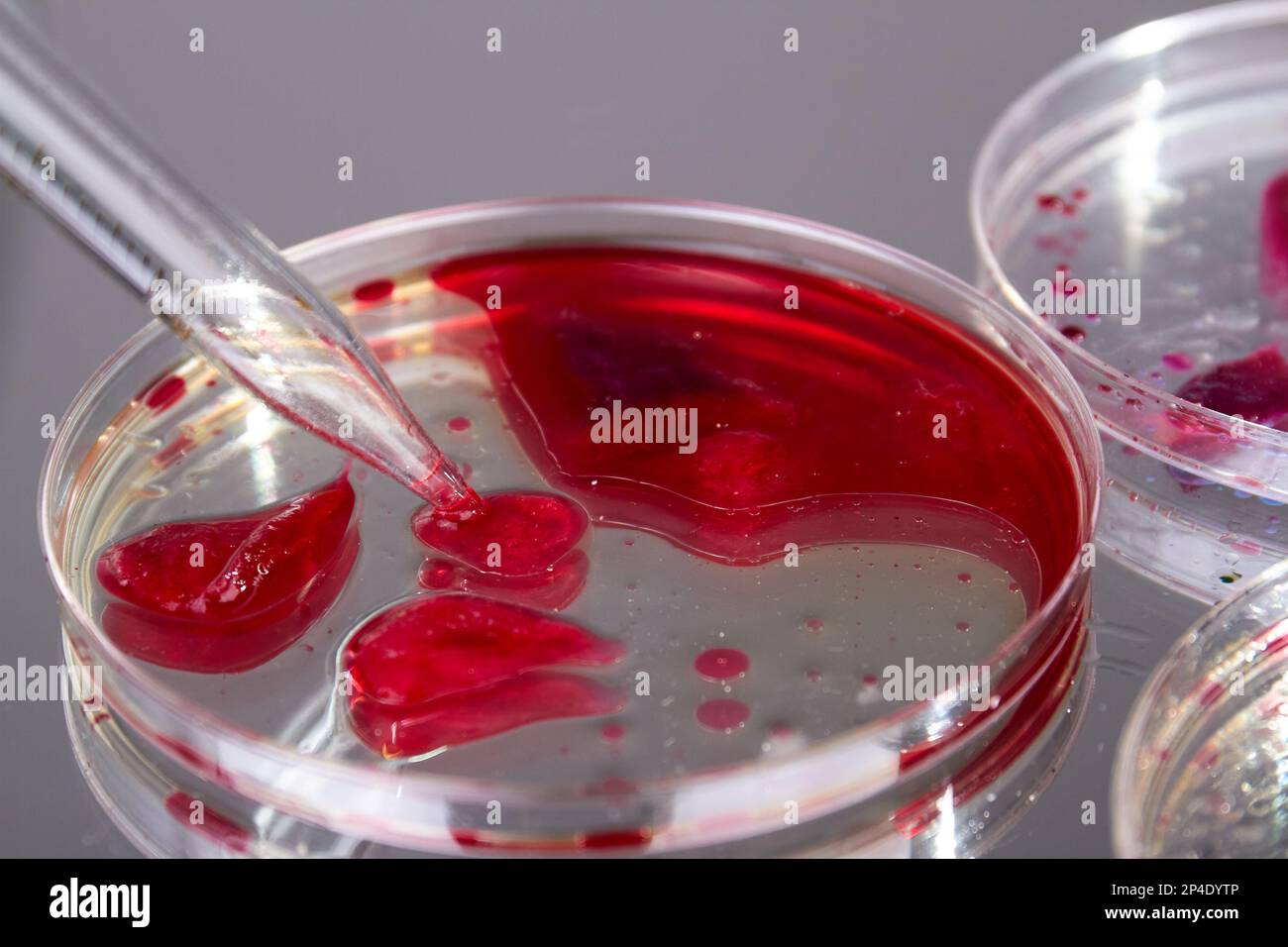Close up lab agar with blood samples. Petri dish on gray background Stock Photo - Alamy
