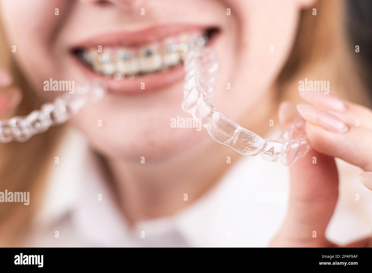 woman beautiful smile holding a transparent mouth guard Stock Photo - Alamy