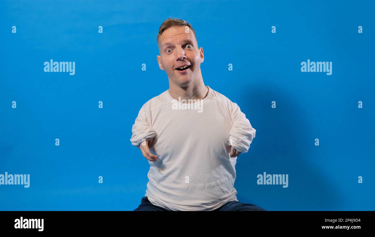 a man with disabilities expresses surprise on his face on an isolated ...