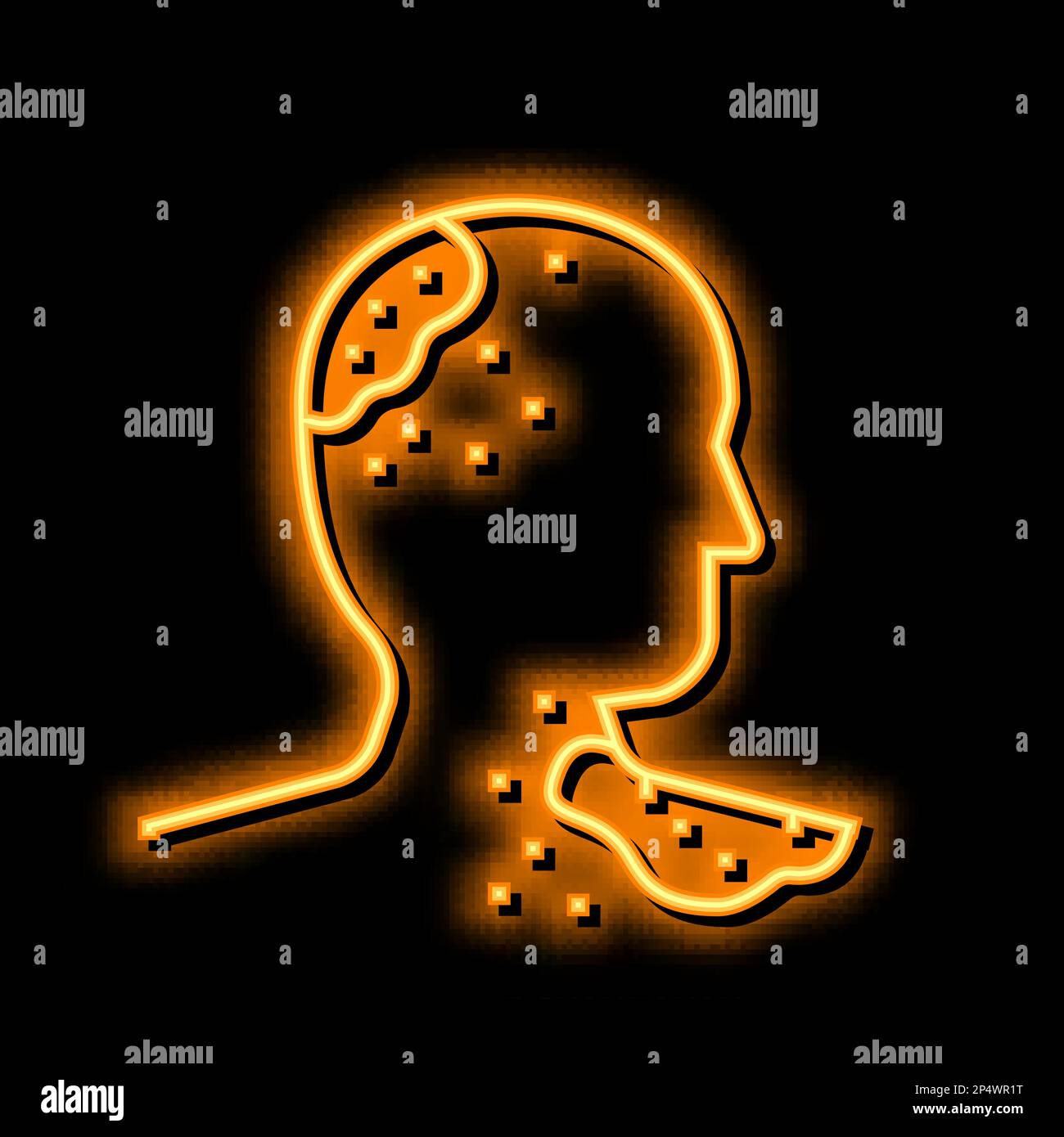 allergy skin neon glow icon illustration Stock Vector Image & Art - Alamy