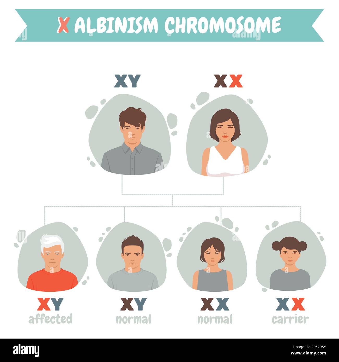 International albinism awareness day. Albinism chromosome.Genetic rare ...