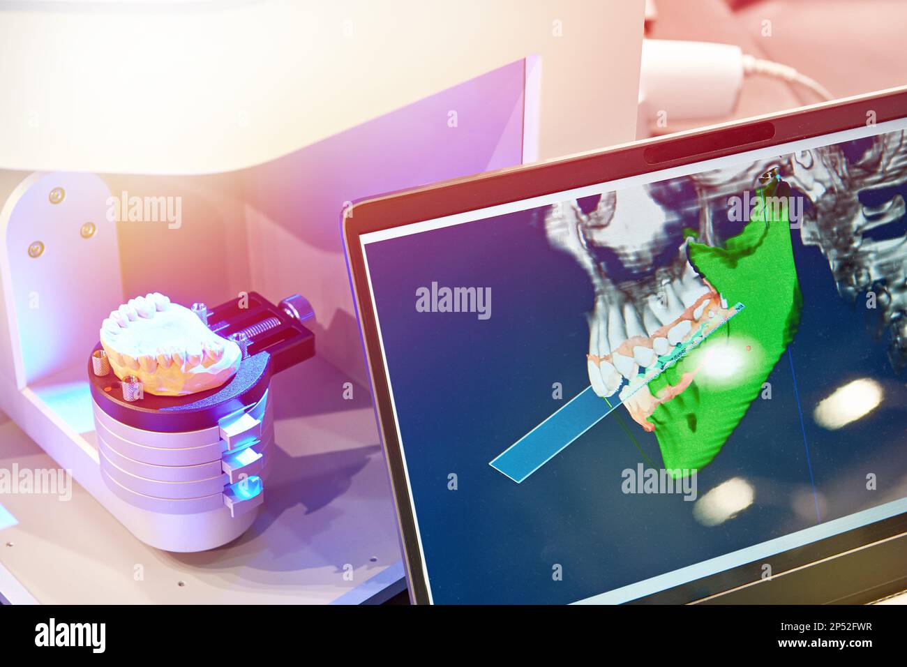 Modern dental equipment for dentures and monitor Stock Photo - Alamy