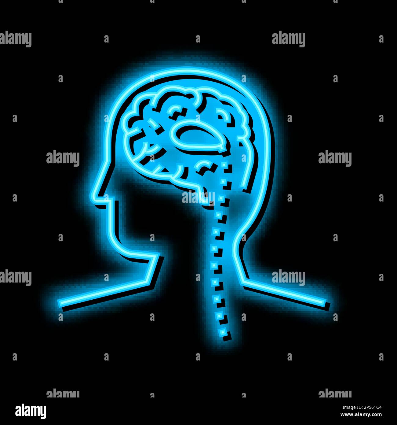 shunt insertion or revision neon glow icon illustration Stock Vector ...