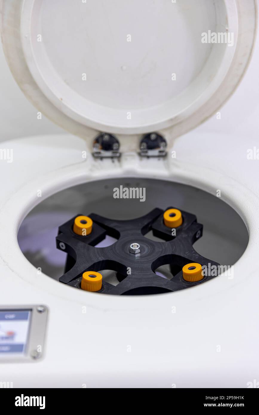 The blood tube is removed from the medical centrifuge for plasma ...