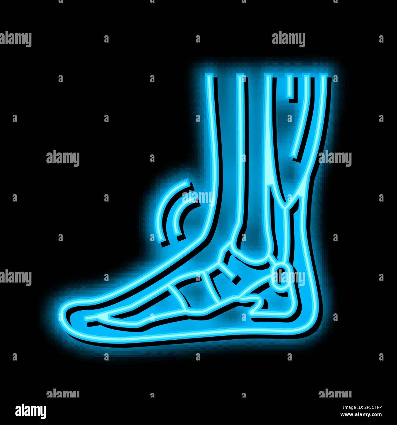 tendonitis problem neon glow icon illustration Stock Vector Image & Art ...